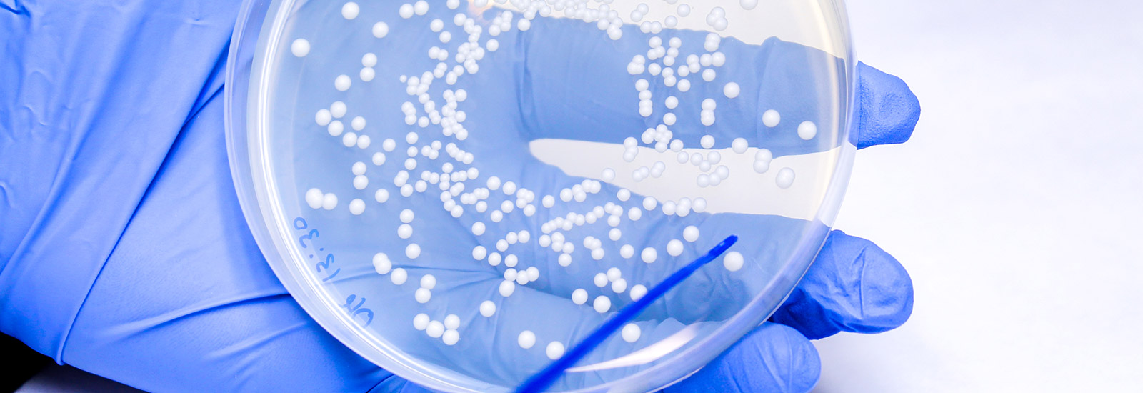 Microbiological analyses